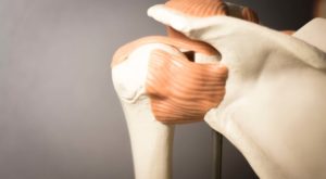 Shoulder Bursitis Physical Therapy - In Motion O.C.